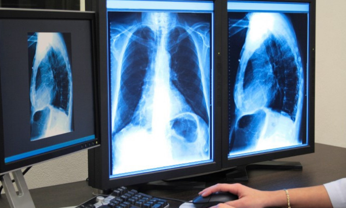 Tout savoir sur la radiographie : la maison de l'enfant